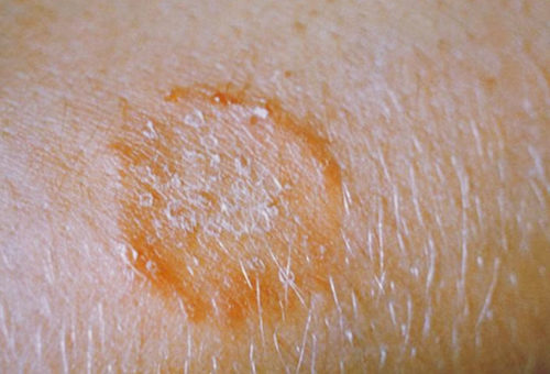 Common pediatric recreation and sport's injuries